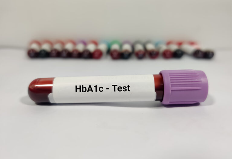 Why Is the Hba1c Test Important for Diabetes Management? - Matrix